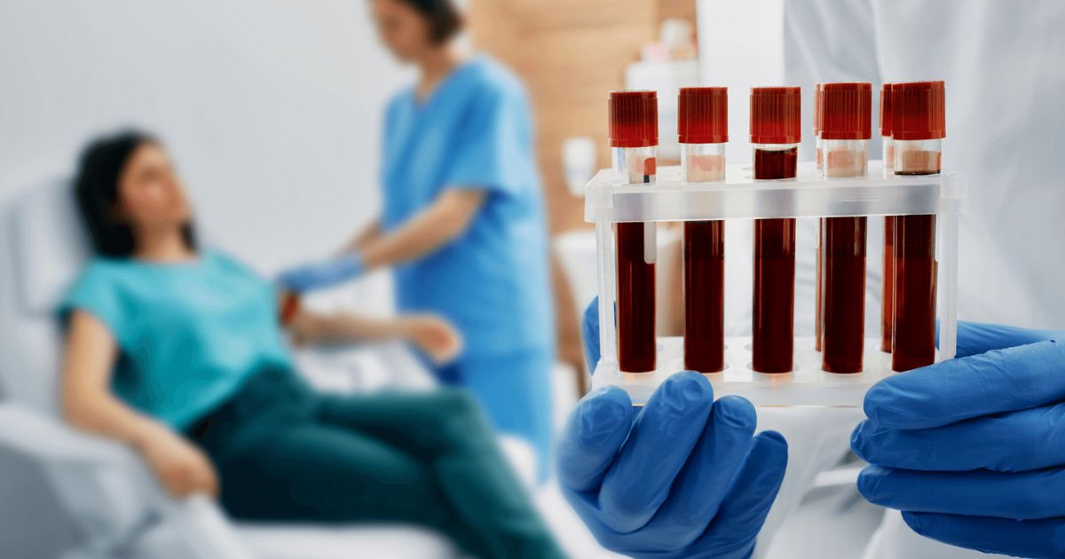 Sex Hormone-Binding Globulin Test (SHBG Blood Test): How Testosterone ...